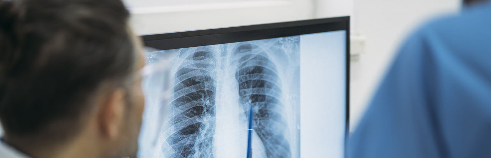 Emploi SIMAGO - Manip Radio - La Réunion CDI